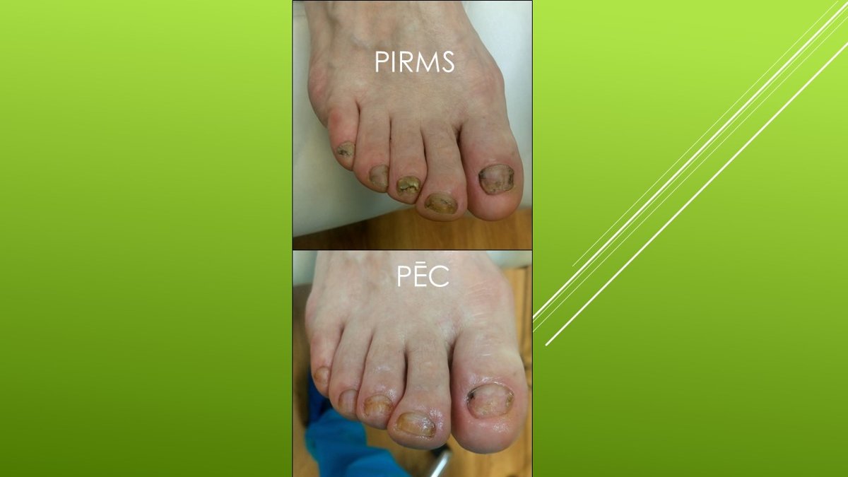 podologs t.27528062 pēdu aprūpe